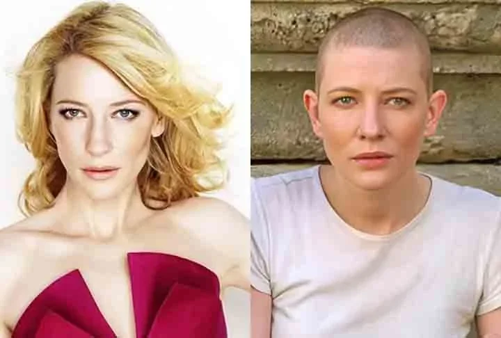 Mudanças radicais: Atrizes ficaram carecas para cinema e TV